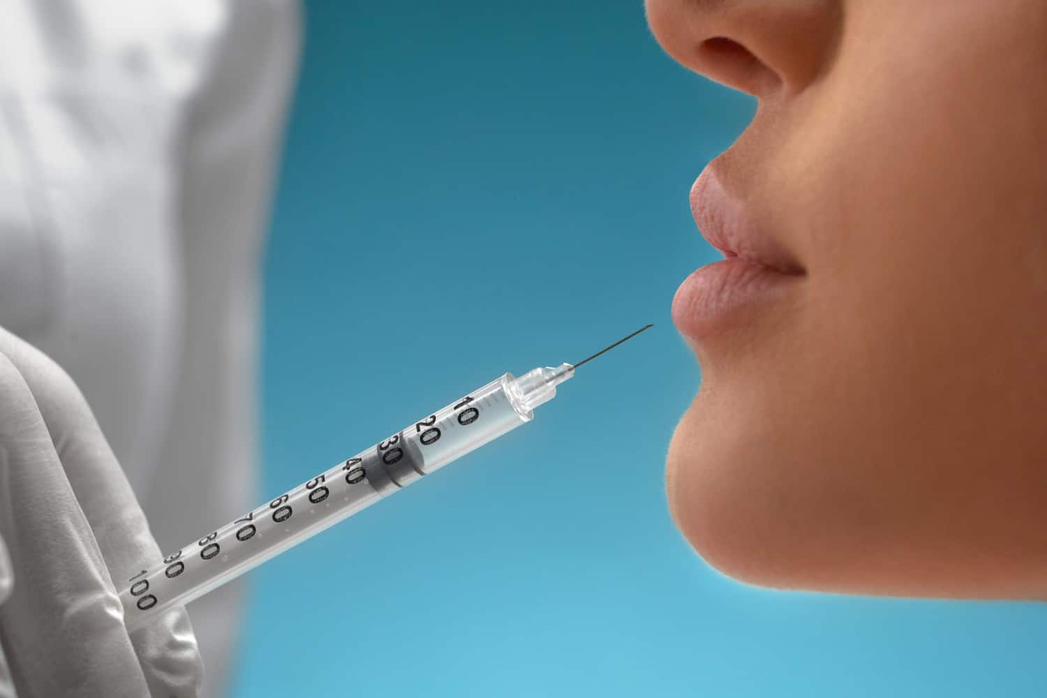 Injections d'acide hyaluronique pour le visage : Déroulement